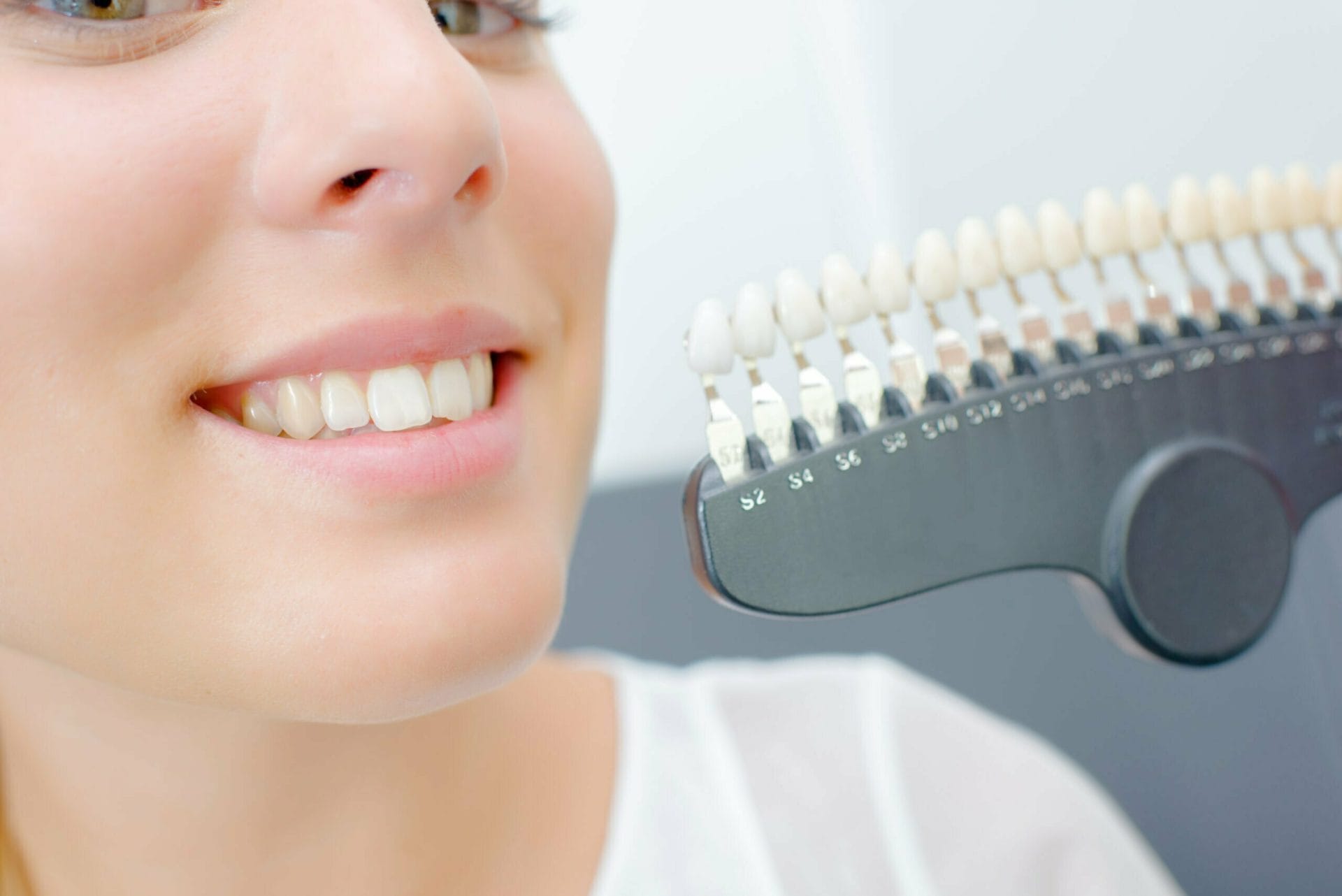 What Is The Best Way To Deal With Stained Teeth? | Blog