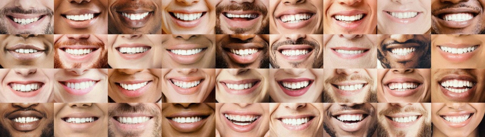 A Smile Is Worth A Thousand Words | Blog
