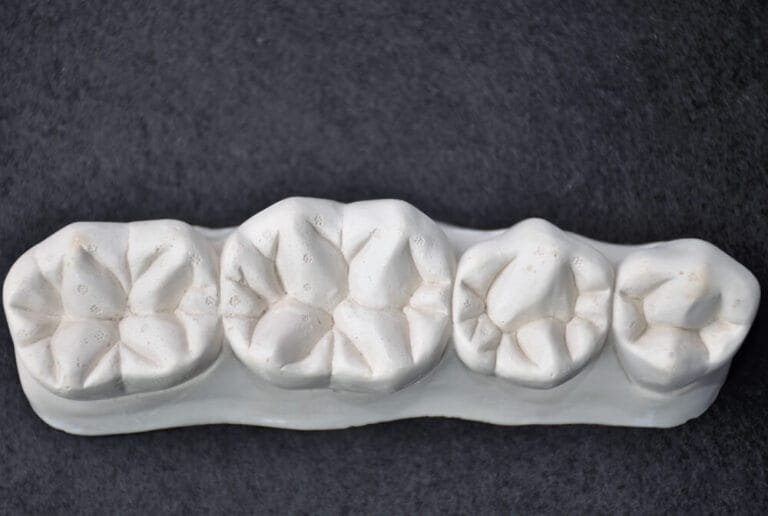 What are Premolars? | Pre Molar Teeth Guide | Aesthetique